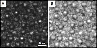 Retinal Physician | PentaVision