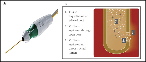 Retinal Physician | PentaVision
