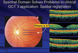 Retinal Physician | PentaVision