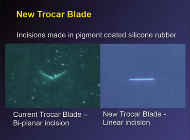 Retinal Physician | PentaVision