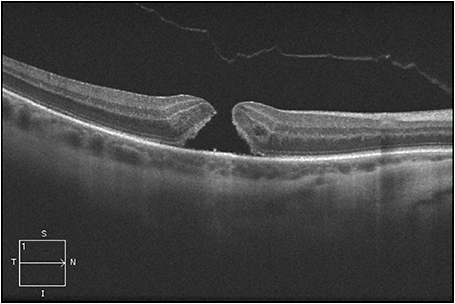 Retinal Physician | PentaVision
