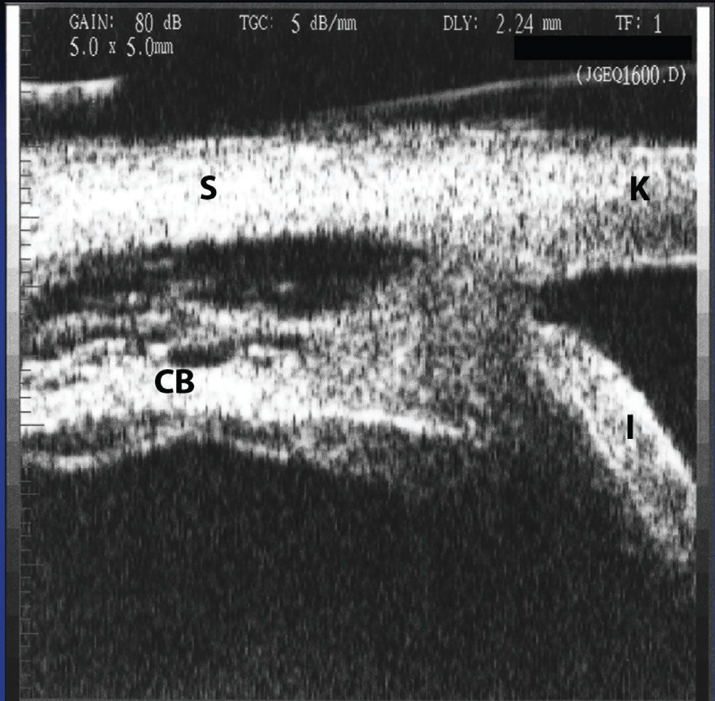 Retinal Physician | PentaVision