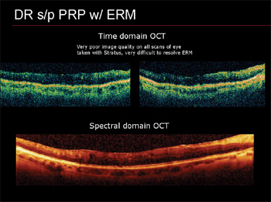 Retinal Physician | PentaVision