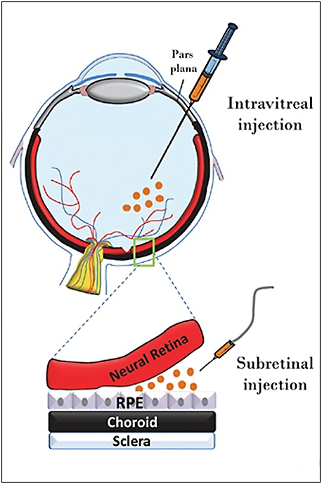 Retinal Physician | PentaVision