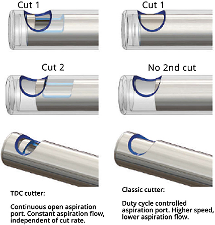 Retinal Physician | PentaVision