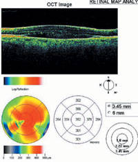Retinal Physician | PentaVision