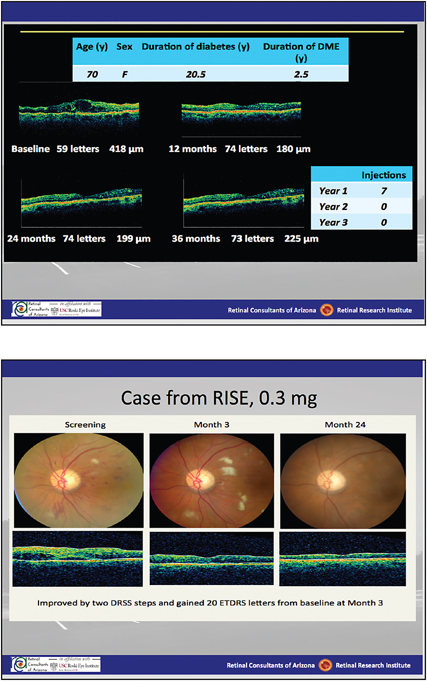 Retinal Physician | PentaVision