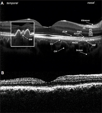 Retinal Physician | PentaVision