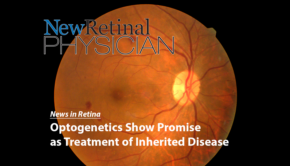 Optogenetics Show Promise as Treatment for Inherited Disease | Retinal ...