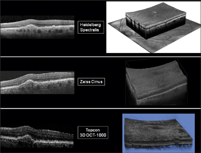 Retinal Physician | PentaVision