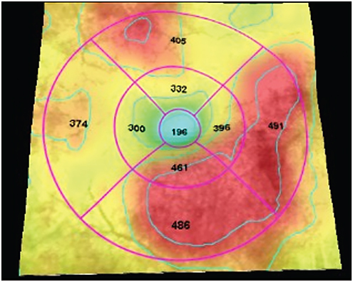 Retinal Physician | PentaVision