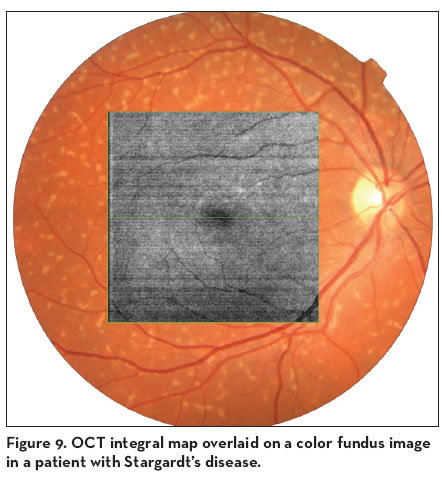 Retinal Physician | PentaVision