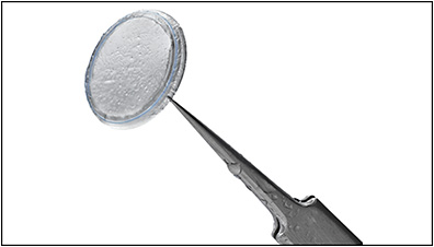 Retinal Physician | PentaVision