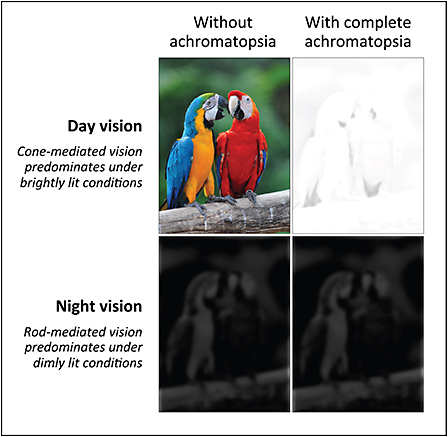 Retinal Physician | PentaVision