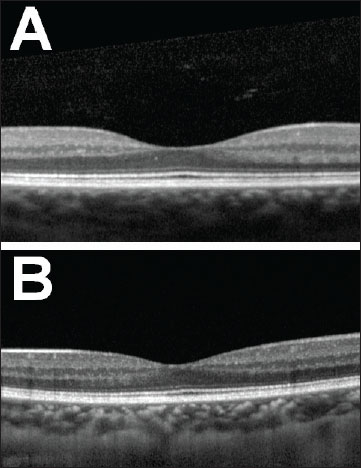 Retinal Physician | PentaVision