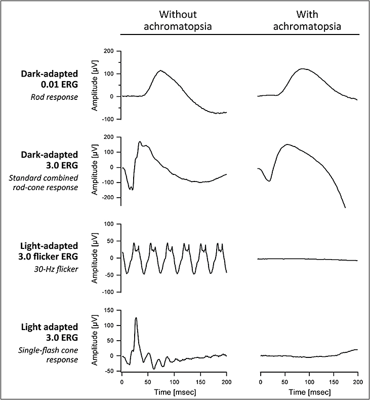 Retinal Physician | PentaVision