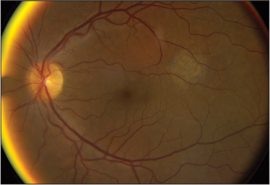 Retinal Physician | PentaVision