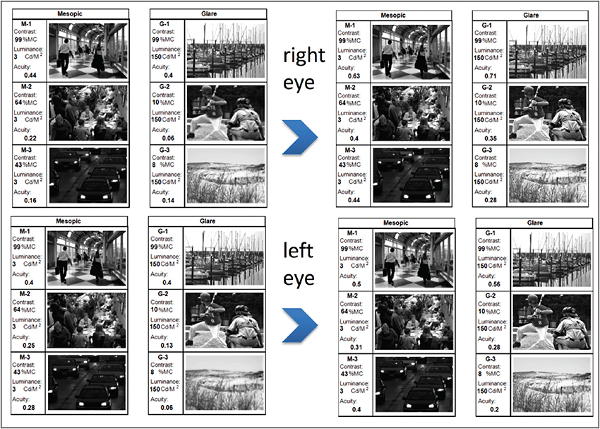 Retinal Physician | PentaVision