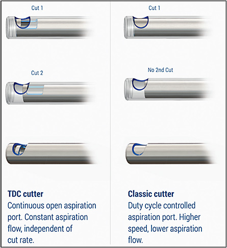 Retinal Physician | PentaVision