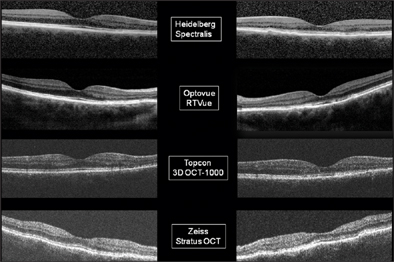 Retinal Physician | PentaVision