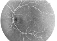 Retinal Physician | PentaVision