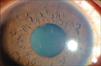 Retinal Physician | PentaVision