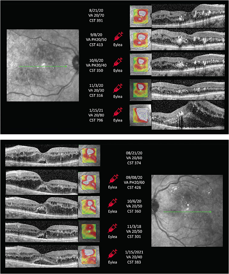 Retinal Physician | PentaVision