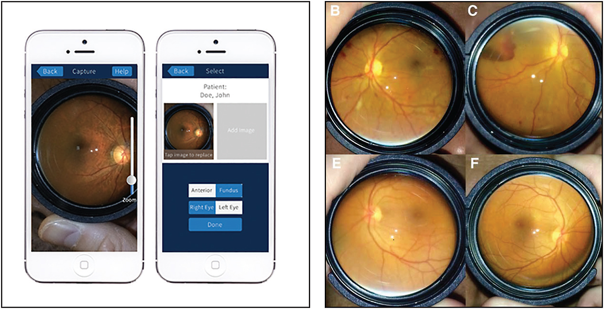Retinal Physician | PentaVision