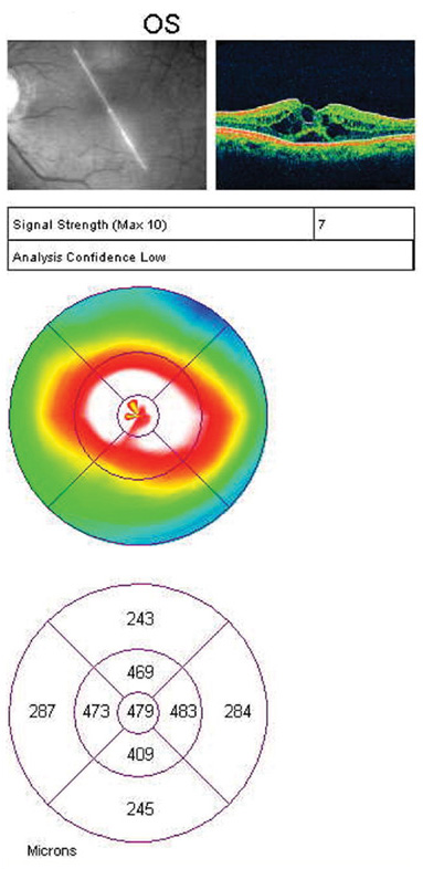 Retinal Physician | PentaVision