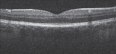 Retinal Physician | PentaVision