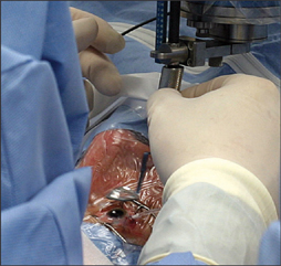 Retinal Physician | PentaVision