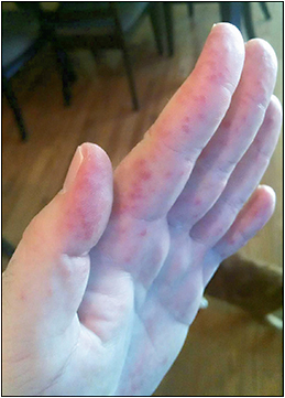 Retinal Physician | PentaVision