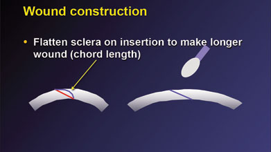 Retinal Physician | PentaVision