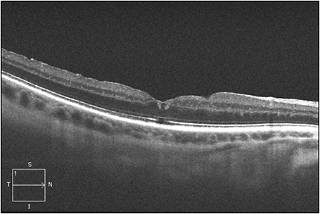 Retinal Physician | PentaVision