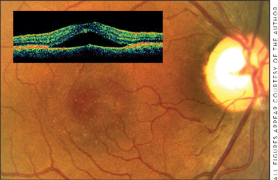 Retinal Physician | PentaVision