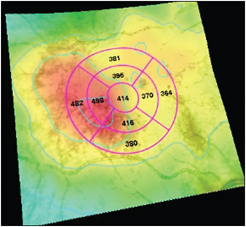 Retinal Physician | PentaVision