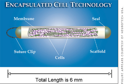 Retinal Physician | PentaVision