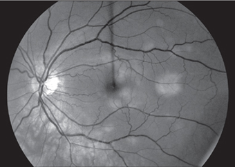 Retinal Physician | PentaVision