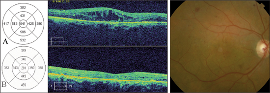 Retinal Physician | PentaVision