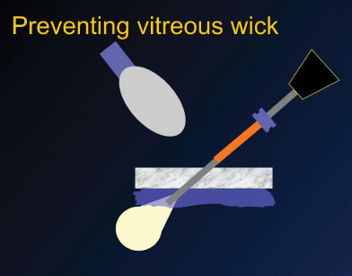 Retinal Physician | PentaVision