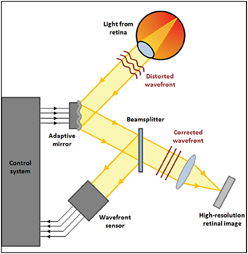 Retinal Physician | PentaVision