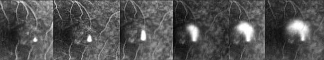 Retinal Physician Pentavision