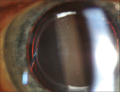 Retinal Physician | PentaVision