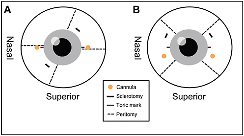 Retinal Physician | PentaVision