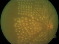 Retinal Physician | PentaVision